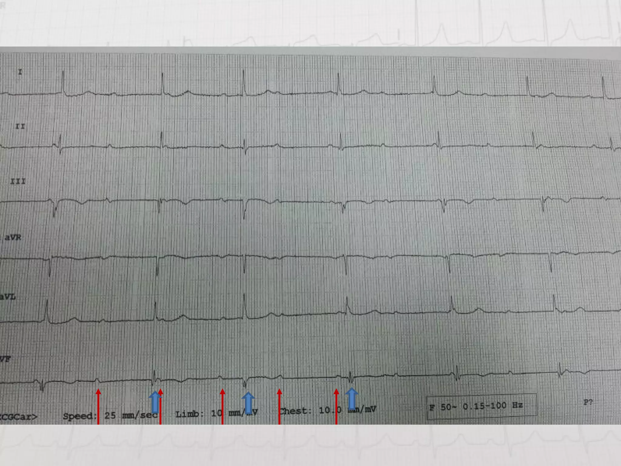 Geraldine Leong - ECG for paramedics | PPT