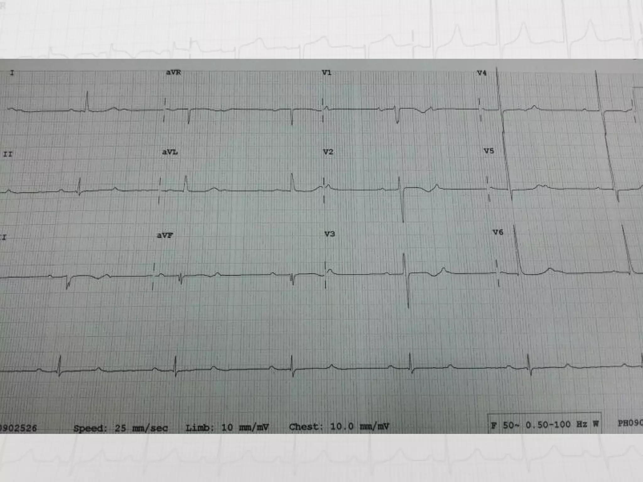 Geraldine Leong - ECG for paramedics | PPT