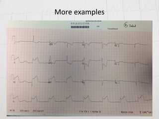 Geraldine Leong - ECG for paramedics | PPT