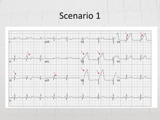 Geraldine Leong - ECG for paramedics | PPT