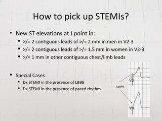 Geraldine Leong - ECG for paramedics | PPT