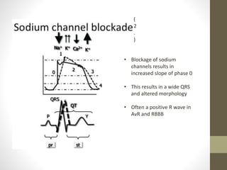 Toxicology and the ECG | PPTX
