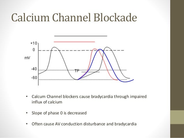 Toxicology and the ECG