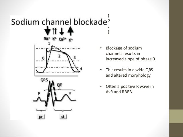 Toxicology and the ECG