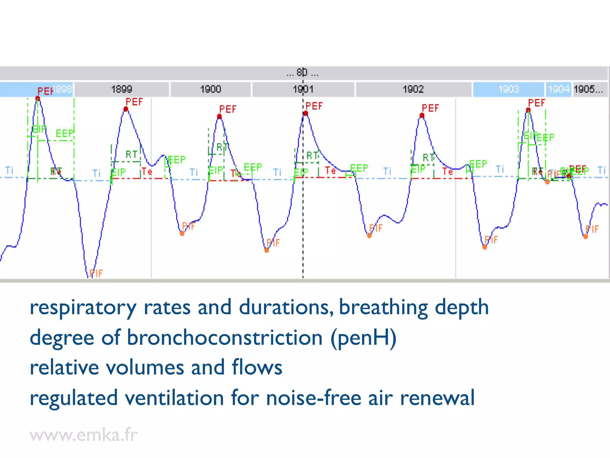 ecgTUNNEL noninvasive ecg and respiration from conscious rats/mice ...