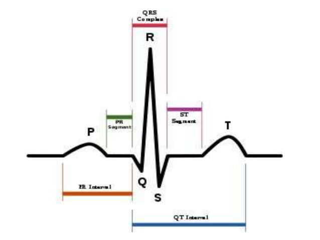 ECG TUTORIAL(Dr Israel).pptx