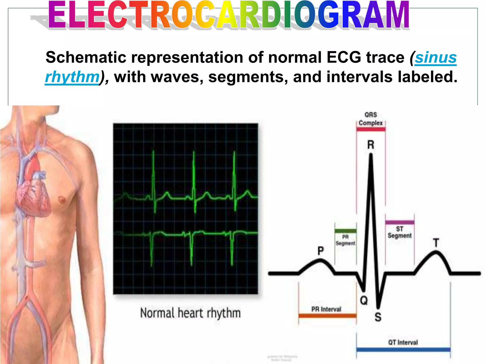 Ecg update(basic cardiology) | PPTX