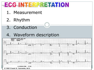 Ecg update(basic cardiology) | PPTX