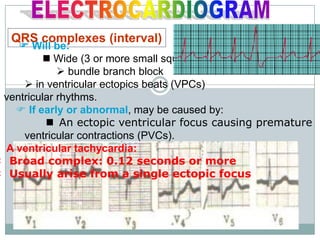 Ecg update(basic cardiology) | PPTX