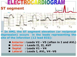 Ecg update(basic cardiology) | PPTX