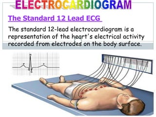 Ecg update(basic cardiology) | PPTX