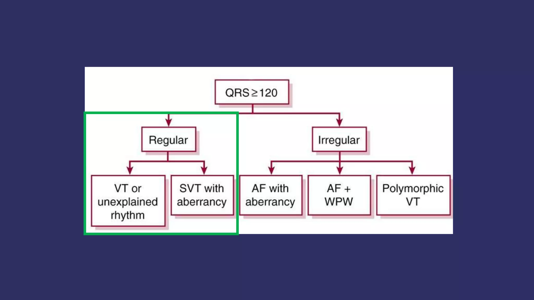 Ecg vtach brugada & vereckei algorithm mec elino | PPTX