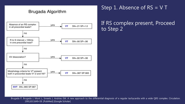 Ecg vtach brugada & vereckei algorithm mec elino | PPTX | Heart and ...