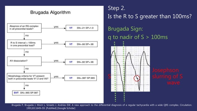 Ecg vtach brugada & vereckei algorithm mec elino | PPTX | Heart and ...
