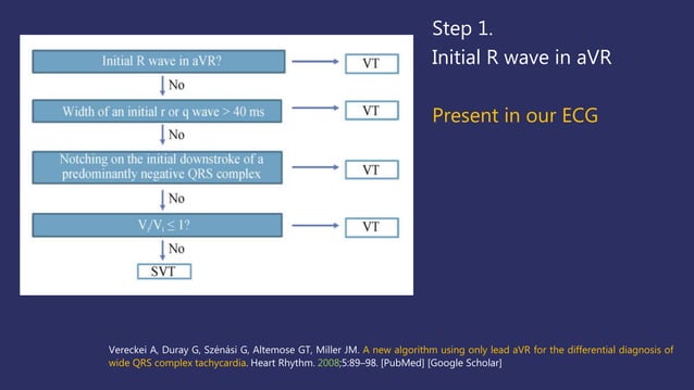 Ecg vtach brugada & vereckei algorithm mec elino | PPTX | Heart and ...