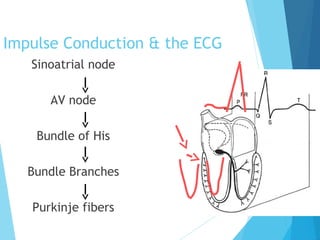 Ecg workshop | PPT