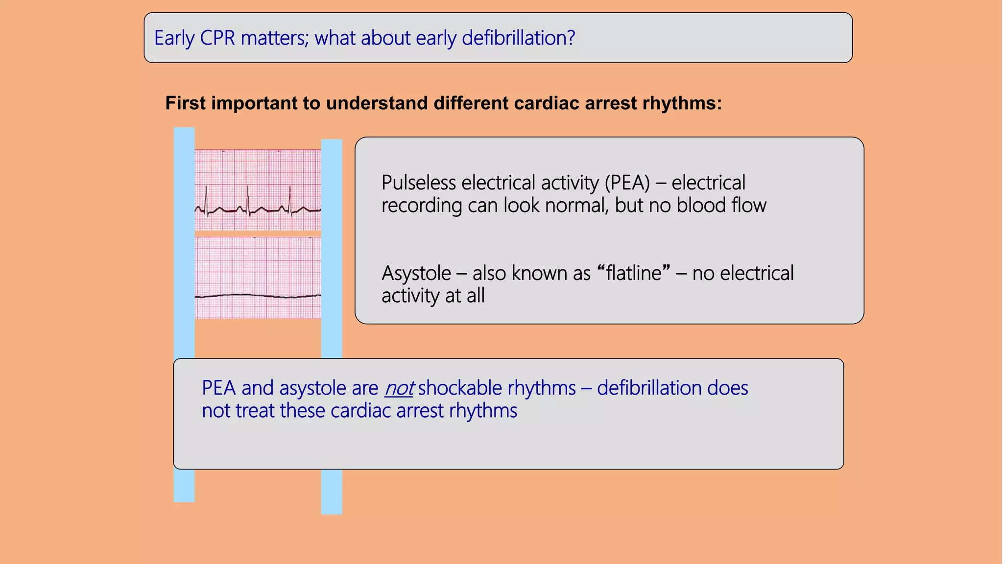 ECG & Emergency Drugs For Nurses | PPT