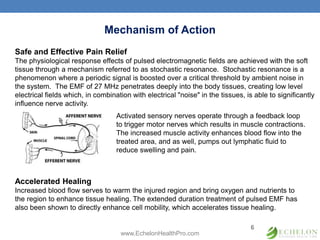 RecoveryRx® Accelerated healing and better pain relief | PPT