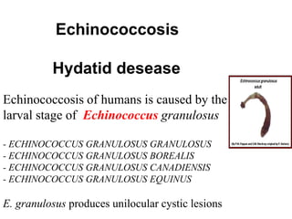 Echinococcosis 10 | PPTX
