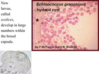 Echinococcosis 10 | PPTX