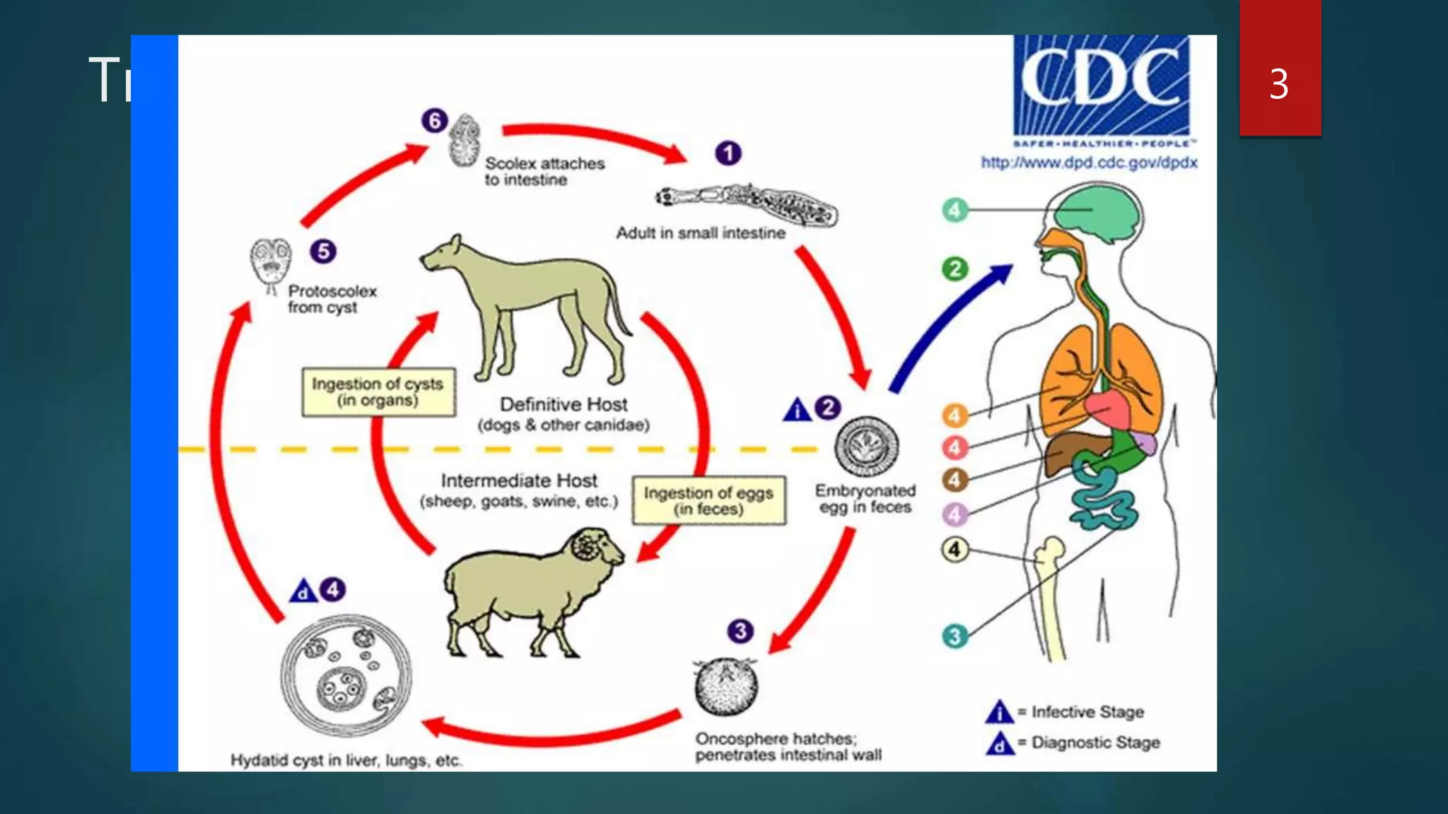 Echinococcosis, signs and symptoms, diagnosis and management. | PPTX