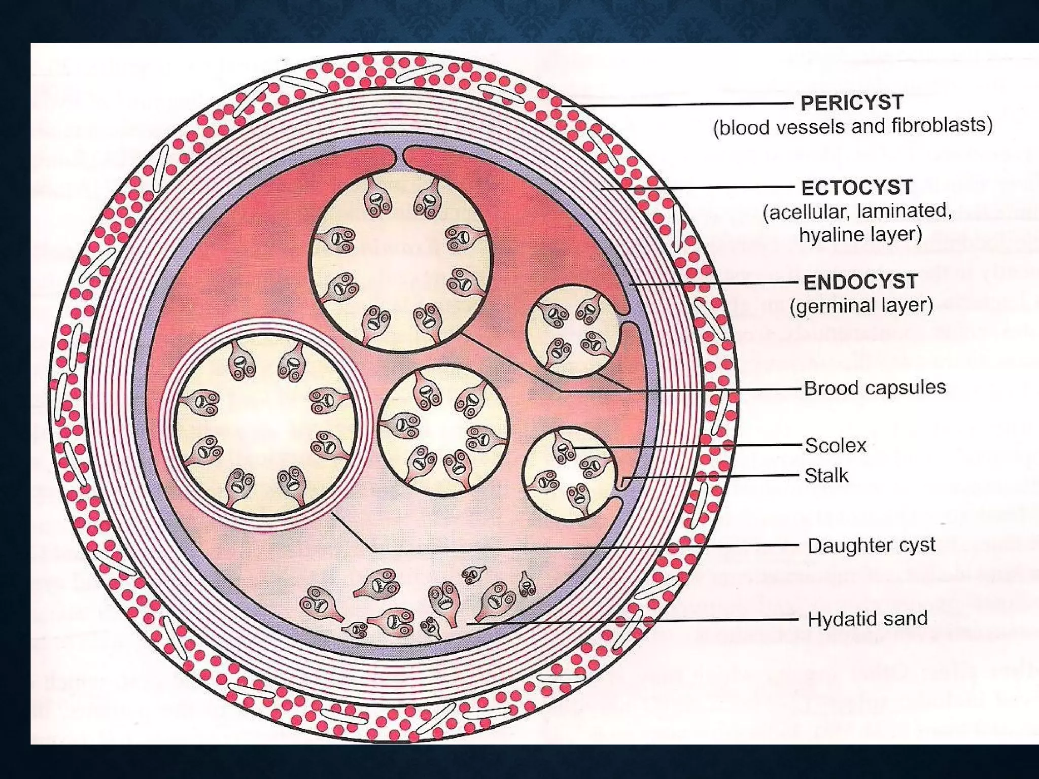 Echinococcus | PPT