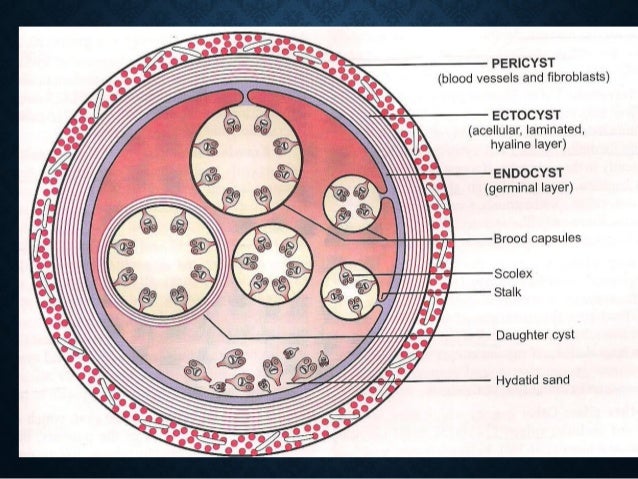 Echinococcus Granulosus Hydatid Cyst