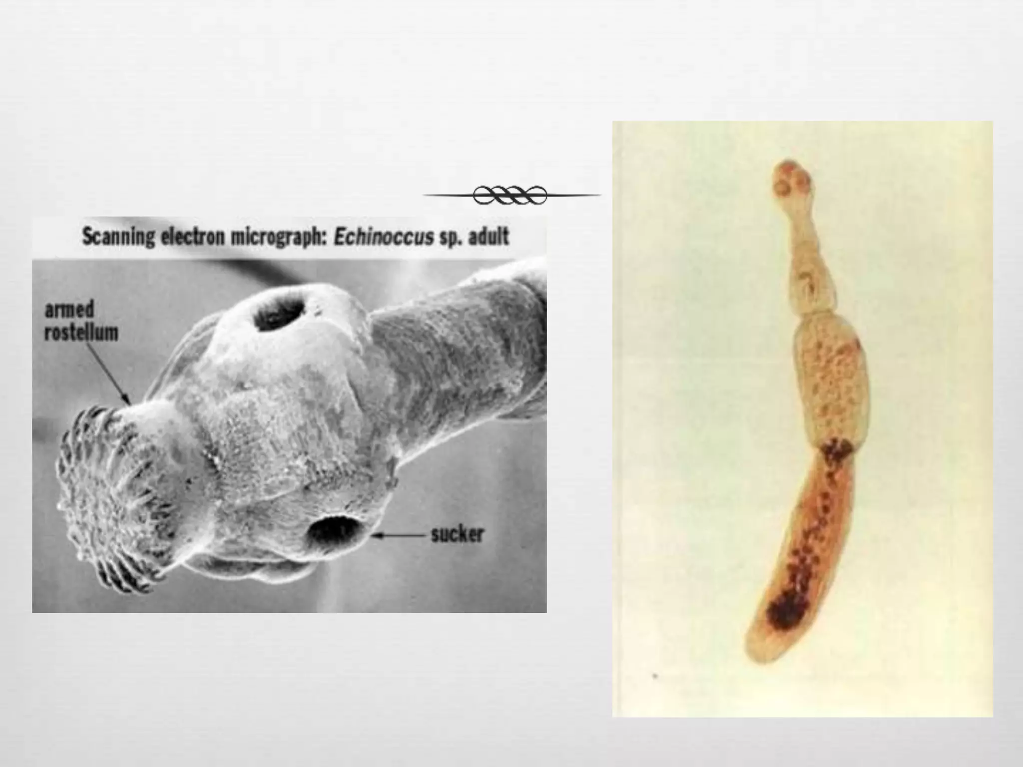 Echinococcosis | PPTX