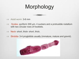 Echinococcosis | PPTX