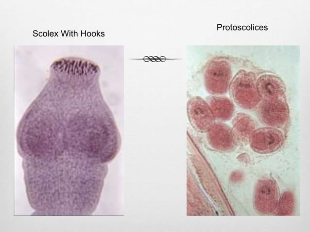 Echinococcosis | PPTX | Lung and Respiratory Health | Diseases and ...