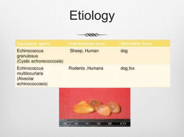 Echinococcosis | PPTX | Lung and Respiratory Health | Diseases and Conditions