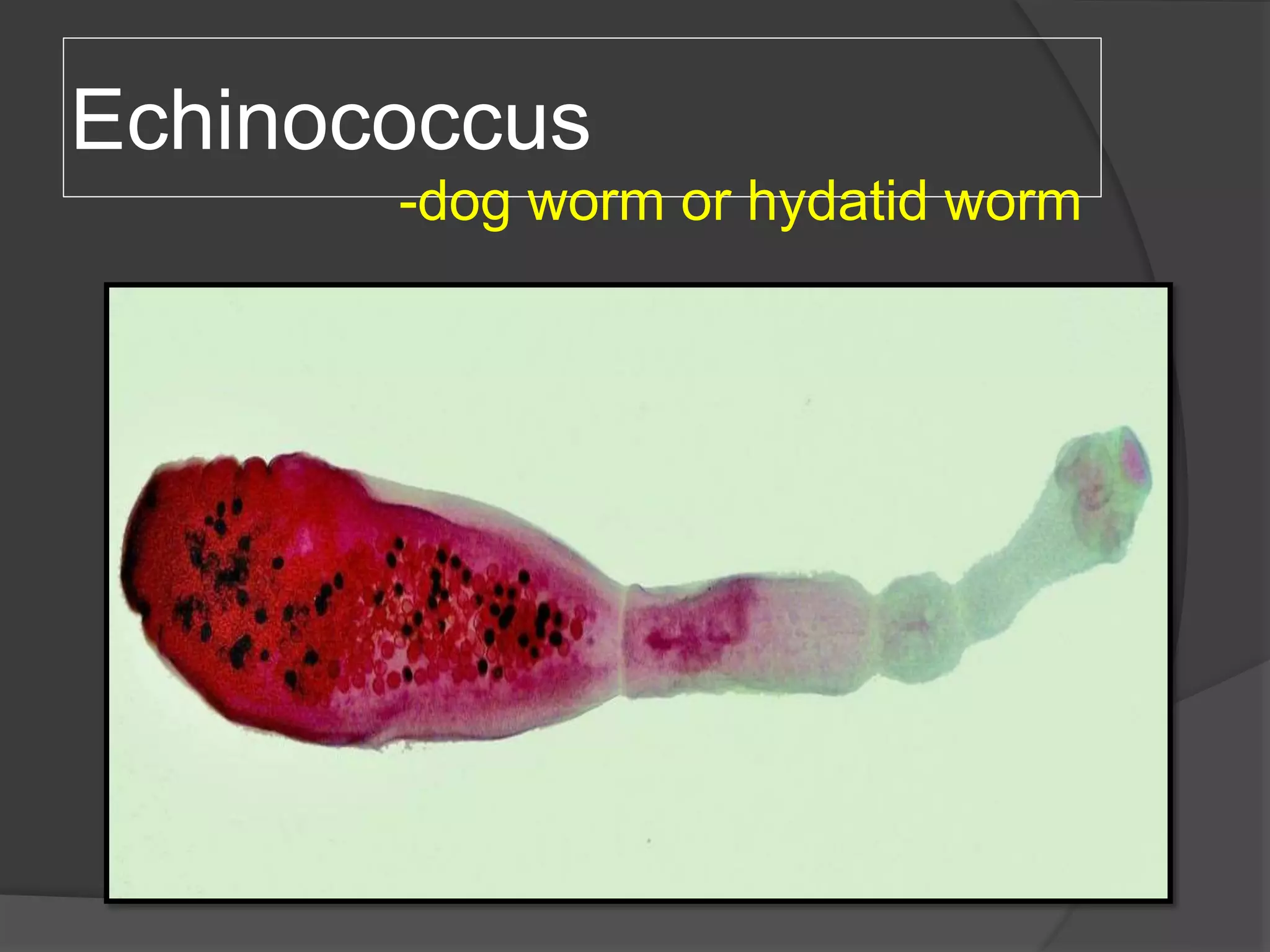 Echinococcus | PPTX