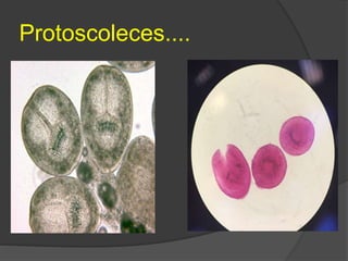 Echinococcus | PPTX