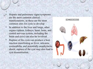 Echinococcus granulosis disease powerpoint | PPT