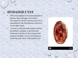 Echinococcus granulosis disease powerpoint | PPTX
