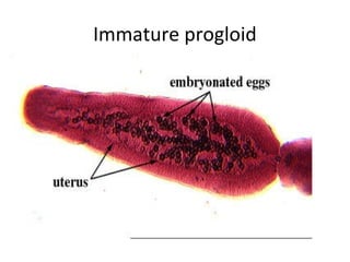 Echinococcus Granulosus Slide