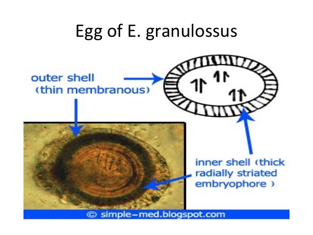 Echinococcus Granulosus Egg Morphology PPT HYMENOLEPIS DIMINUTA