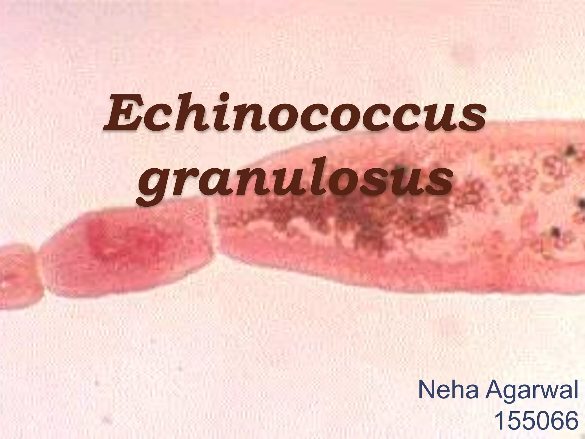 Echinococcus granulosus | PPTX