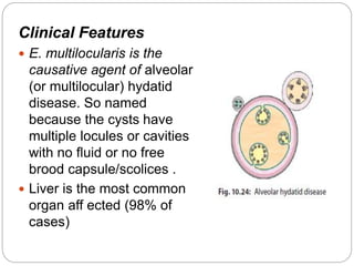 Echinococcus Ova