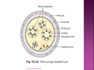 Echinococcus Granulosus Labeled