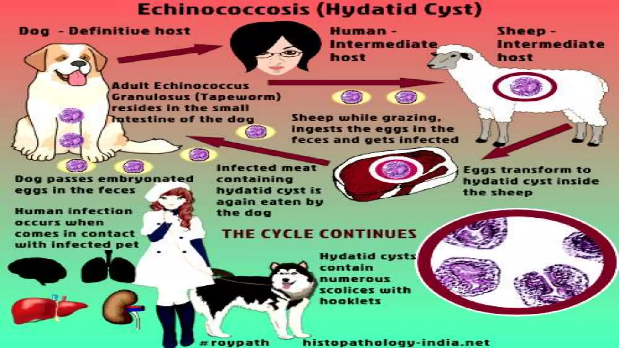 Echinococcus granulosus - ANAND GURMAITA | PPT
