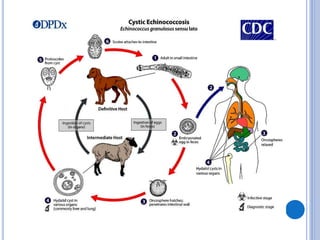 Echinococcus granulosus ( hydatid worm).pptx