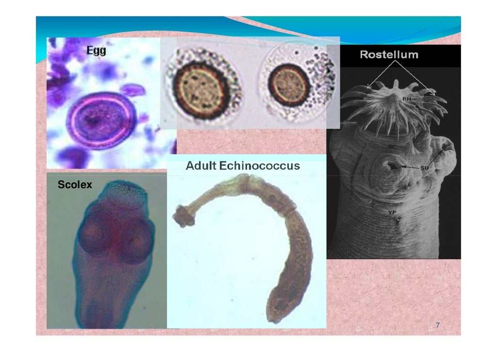 Echinococcus species