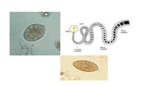Echinococcus sps and spirochetes spp ptx. | PPTX