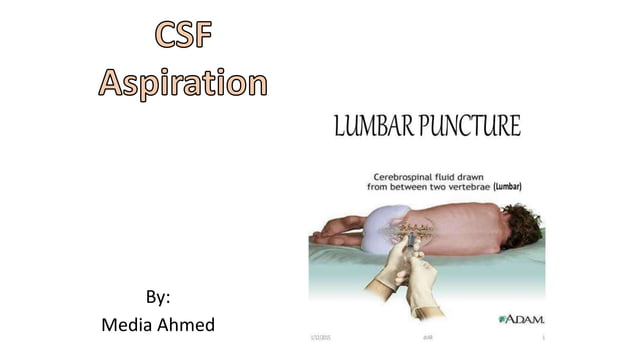 Echocardiography, CSF study, IV and IM injections | PPT