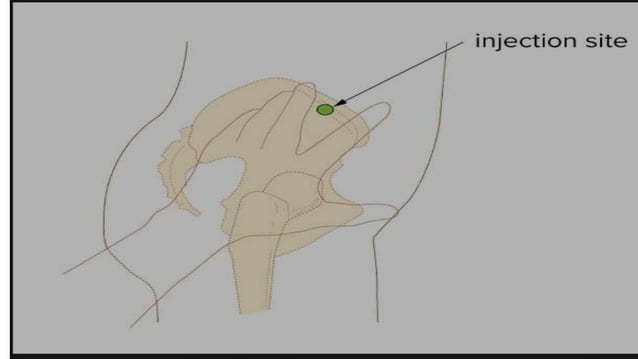 Echocardiography, CSF study, IV and IM injections | PPT