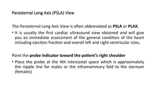 NORMAL ECHOCARDIOGRAPHIC ANATOMY OF THE HEART | PPTX