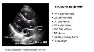 NORMAL ECHOCARDIOGRAPHIC ANATOMY OF THE HEART | PPTX