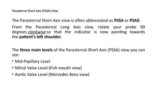 NORMAL ECHOCARDIOGRAPHIC ANATOMY OF THE HEART | PPTX