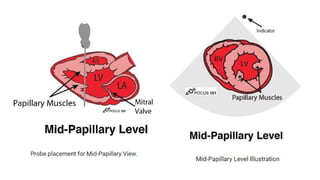 NORMAL ECHOCARDIOGRAPHIC ANATOMY OF THE HEART | PPTX